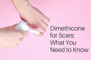 Dimethicone Treatment: A Safe & Effective Solution for Lice